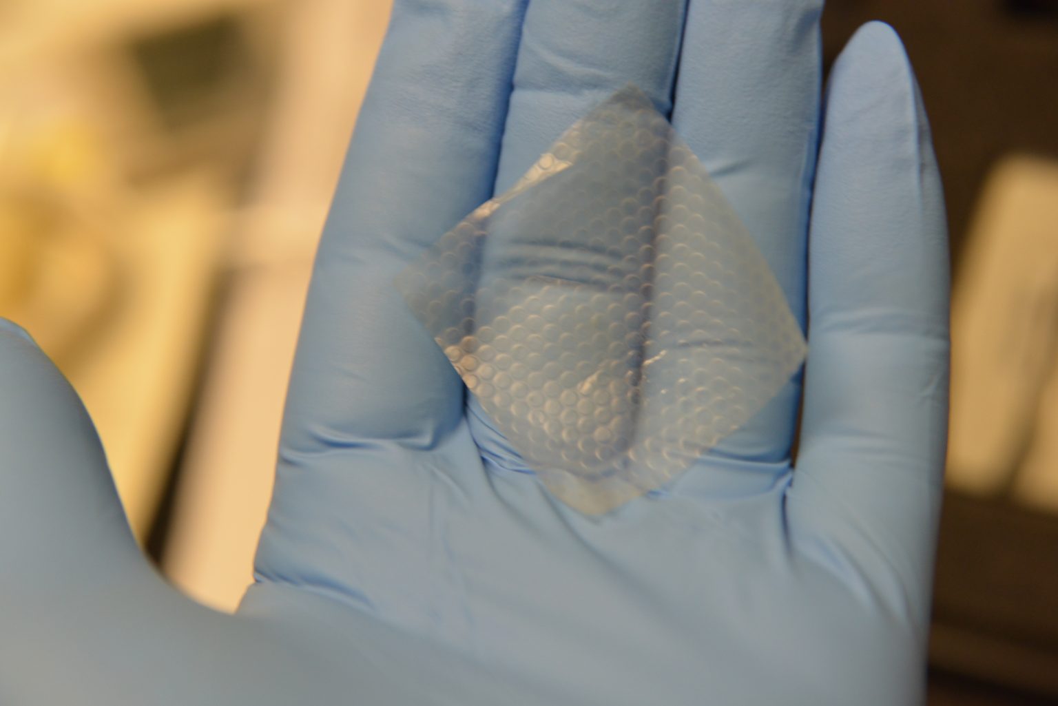 EvoPatch Amnion Patch - Evologics